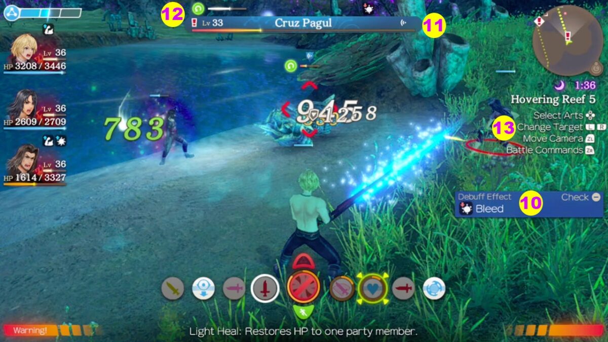 How To Decipher Xenoblade Chronicles: Definitive Edition’s Ridiculously ...